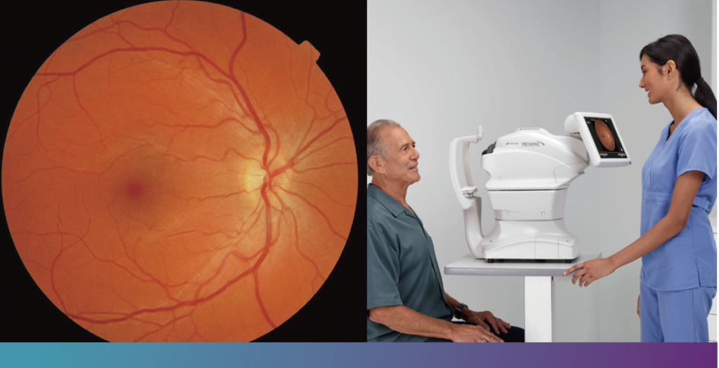 Patient Education | Topcon Screen