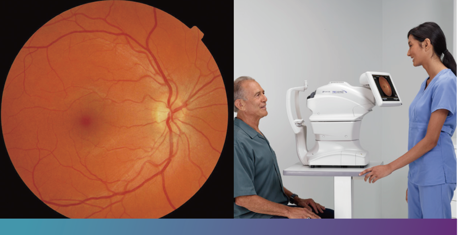 Patient Education | Topcon Screen